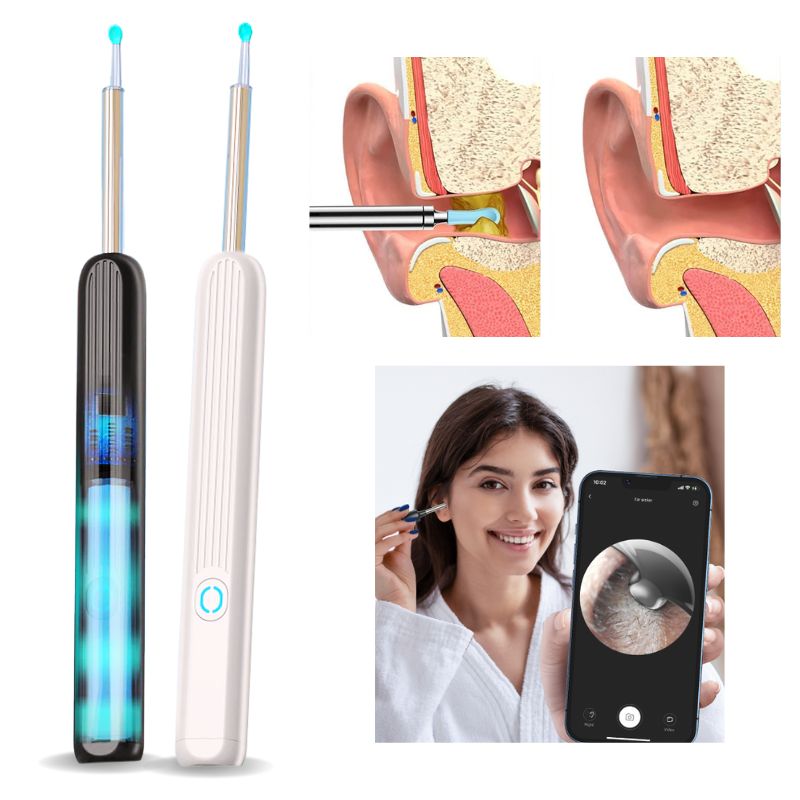 SmartScope Visual Ear Cleaner For Safe and Effective Earwax Removal ...